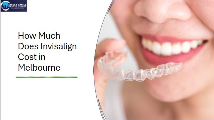 How Much Does Invisalign Cost In Melbourne - Sweet Smile Dental